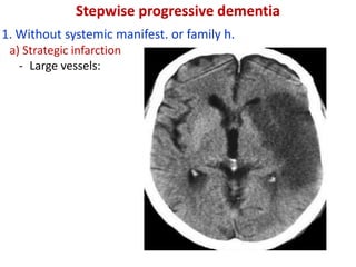 Algorithm for dementia for postgraduates | PPT