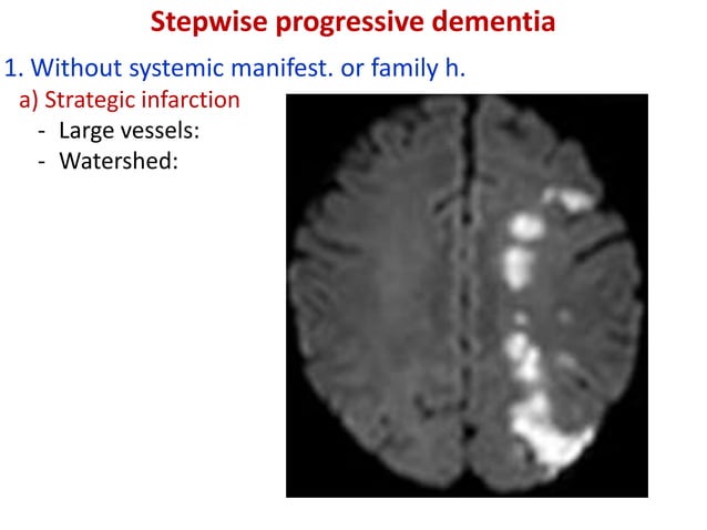 Algorithm for dementia for postgraduates | PPT