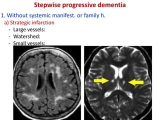 Algorithm for dementia for postgraduates | PPT