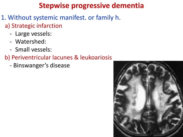 Algorithm for dementia for postgraduates | PPT