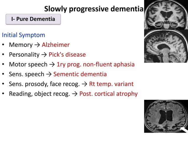 Algorithm for dementia for postgraduates | PPT