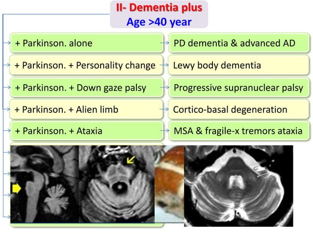 Algorithm for dementia for postgraduates | PPT