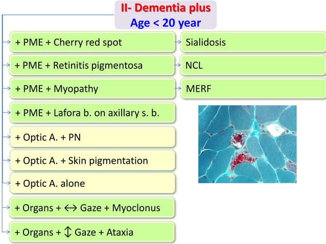 Algorithm for dementia for postgraduates | PPT
