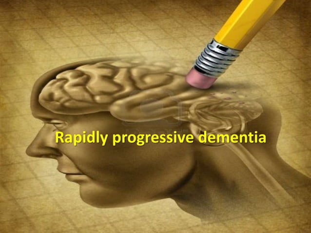 Algorithm for dementia for postgraduates | PPT