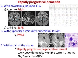 Algorithm for dementia for postgraduates | PPT