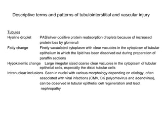 Algorithmic approach to the renal biopsy fellow | PDF