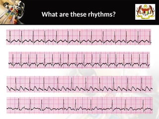 Algorithm NCORT Malaysia 2021 For Healthcare.pptx