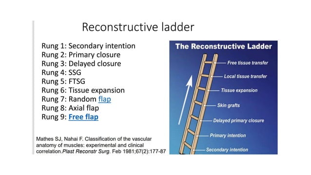 Algorithm To Approach The Lower Extremity Defect And To Select