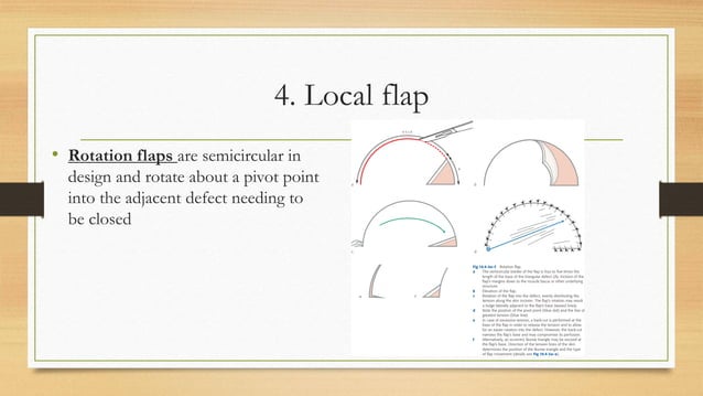 Algorithm To Approach The Lower Extremity Defect And To Select