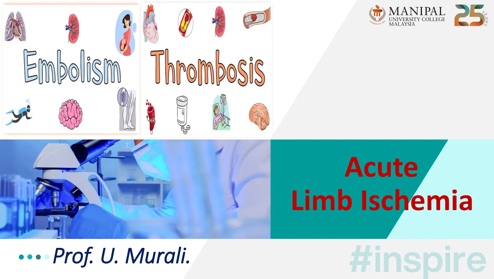 Acute Arerial Diseases - Acute Limb Ischemia | PDF