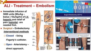 Acute Arerial Diseases - Acute Limb Ischemia | PDF