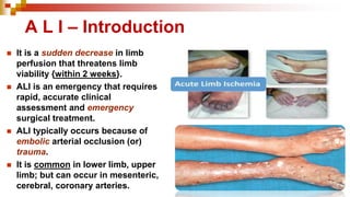 Acute Arerial Diseases - Acute Limb Ischemia | PDF