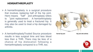 ORTHOPEDIC (HIP BONE) | PPTX