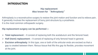 ORTHOPEDIC (HIP BONE) | PPTX