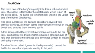 ORTHOPEDIC (HIP BONE) | PPT