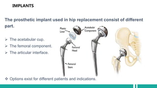 ORTHOPEDIC (HIP BONE) | PPTX