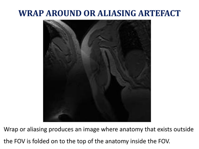 Aliasing or wrap around artifacts | PPT