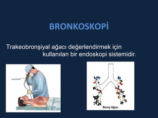 bronkoskopi ünitesi yönetimi | PPT