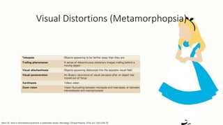 Alice in Wonderland Syndrome | PPTX