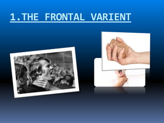 Alien hand-syndrome-1 r (1) | PPT