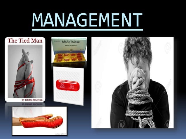 Alien hand-syndrome-1 r (1) | PPT