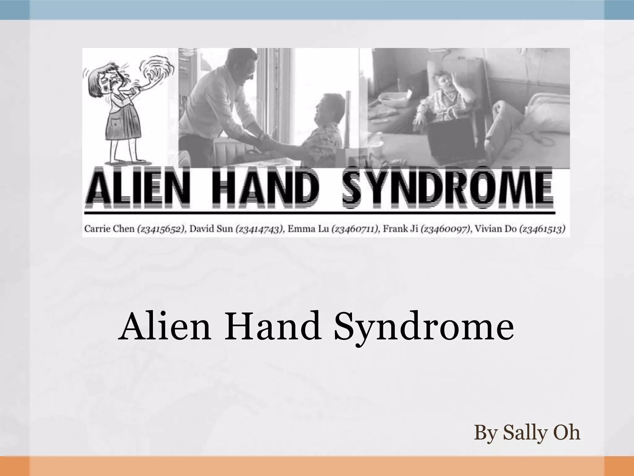 Alien hand syndrome | PPTX