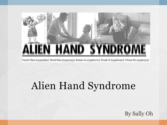Alien hand syndrome | PPTX
