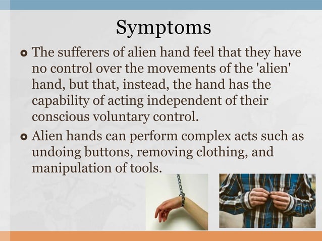 Alien hand syndrome | PPTX