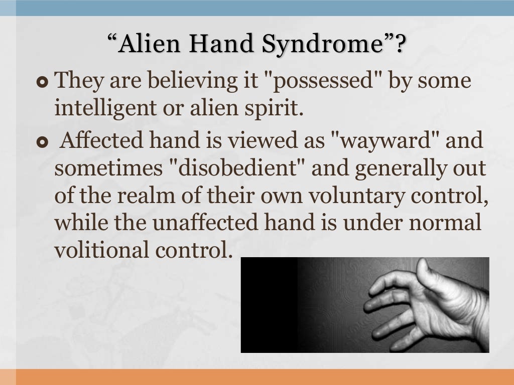 Alien hand syndrome
