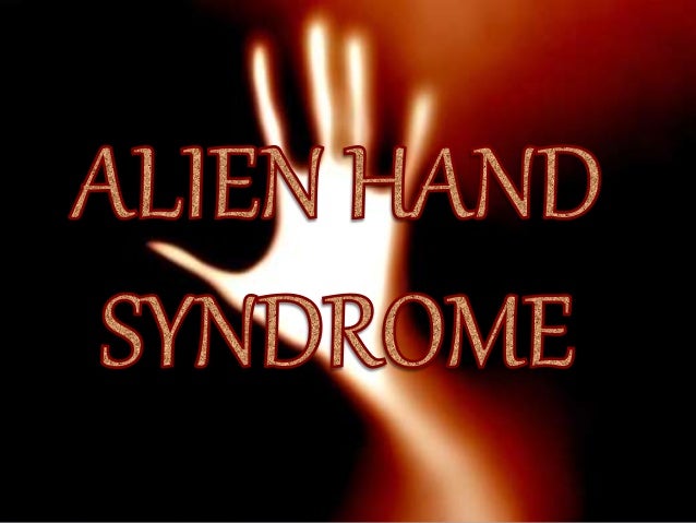 Alien hand syndrome presentation