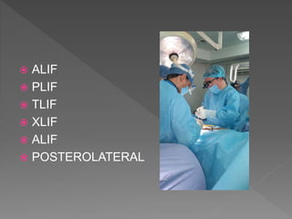 Alif minimamente invasivo | PPT