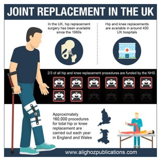 Joint Replacement Statistics - UK | PDF