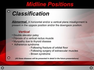 Alignement | PPT