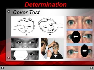 Alignement | PPT