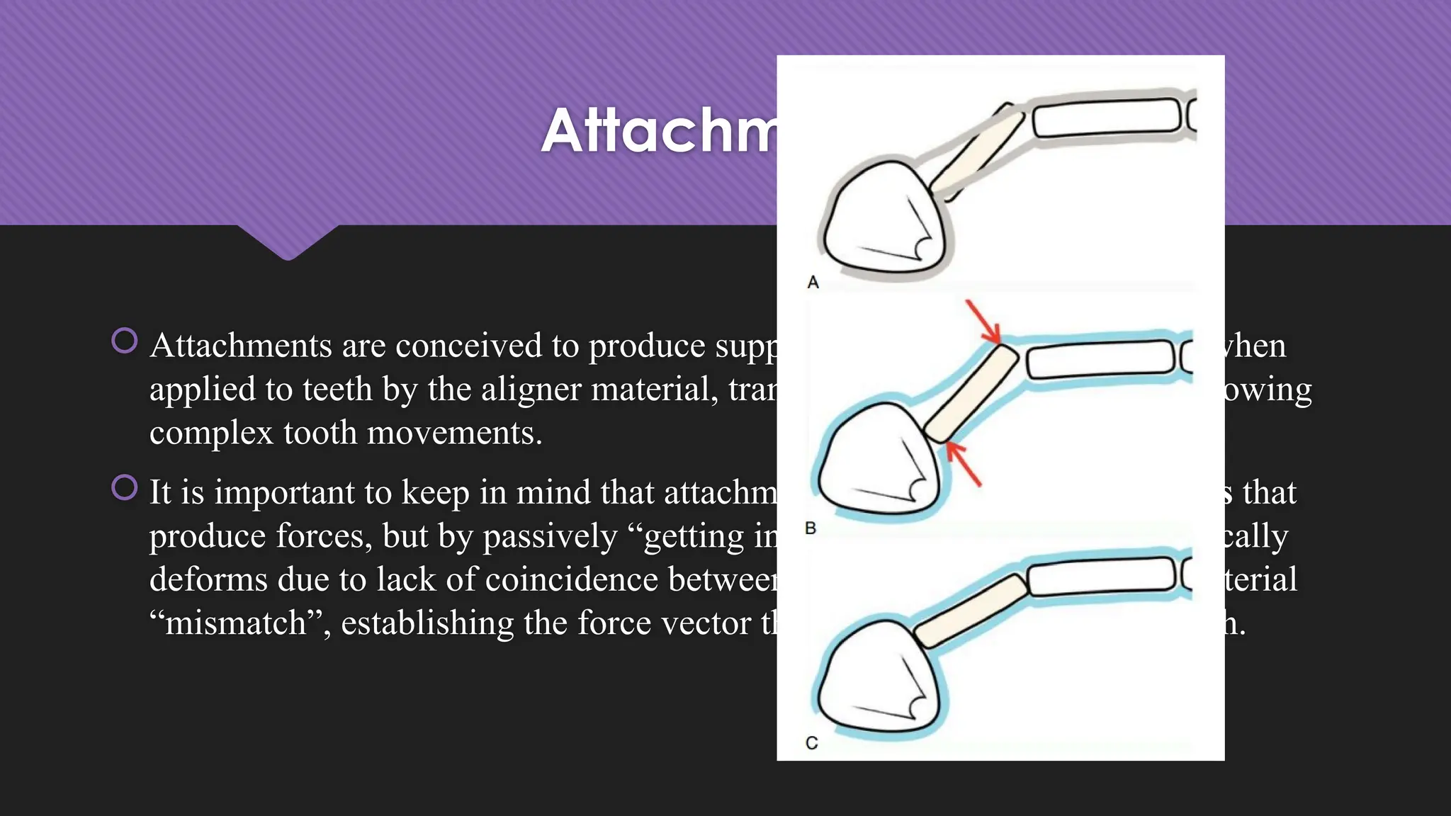 Aligner biomech-1.pptx biomechanics, orthodontics | PPTX