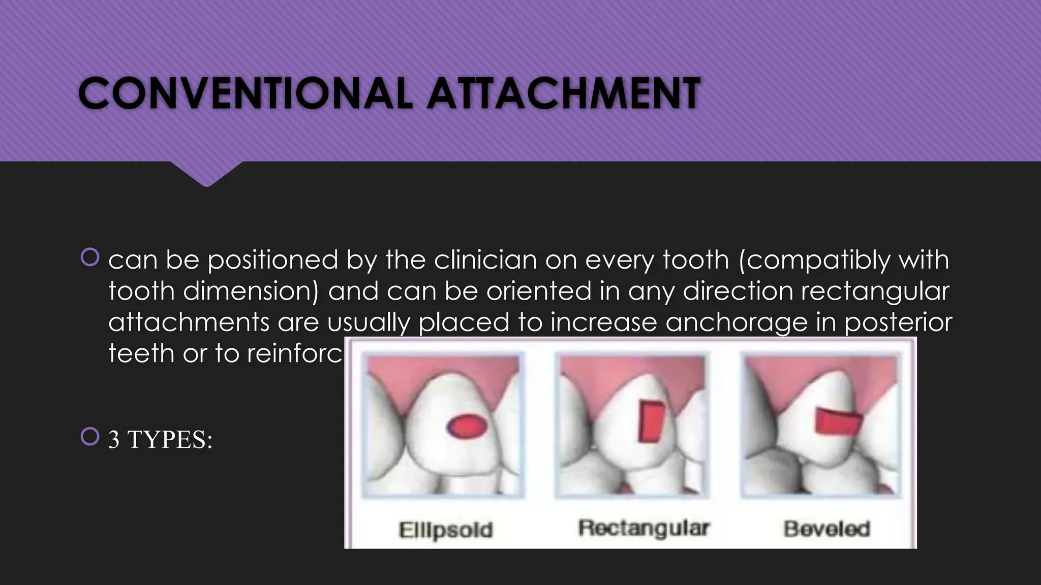 Aligner biomech-1.pptx biomechanics, orthodontics | PPTX