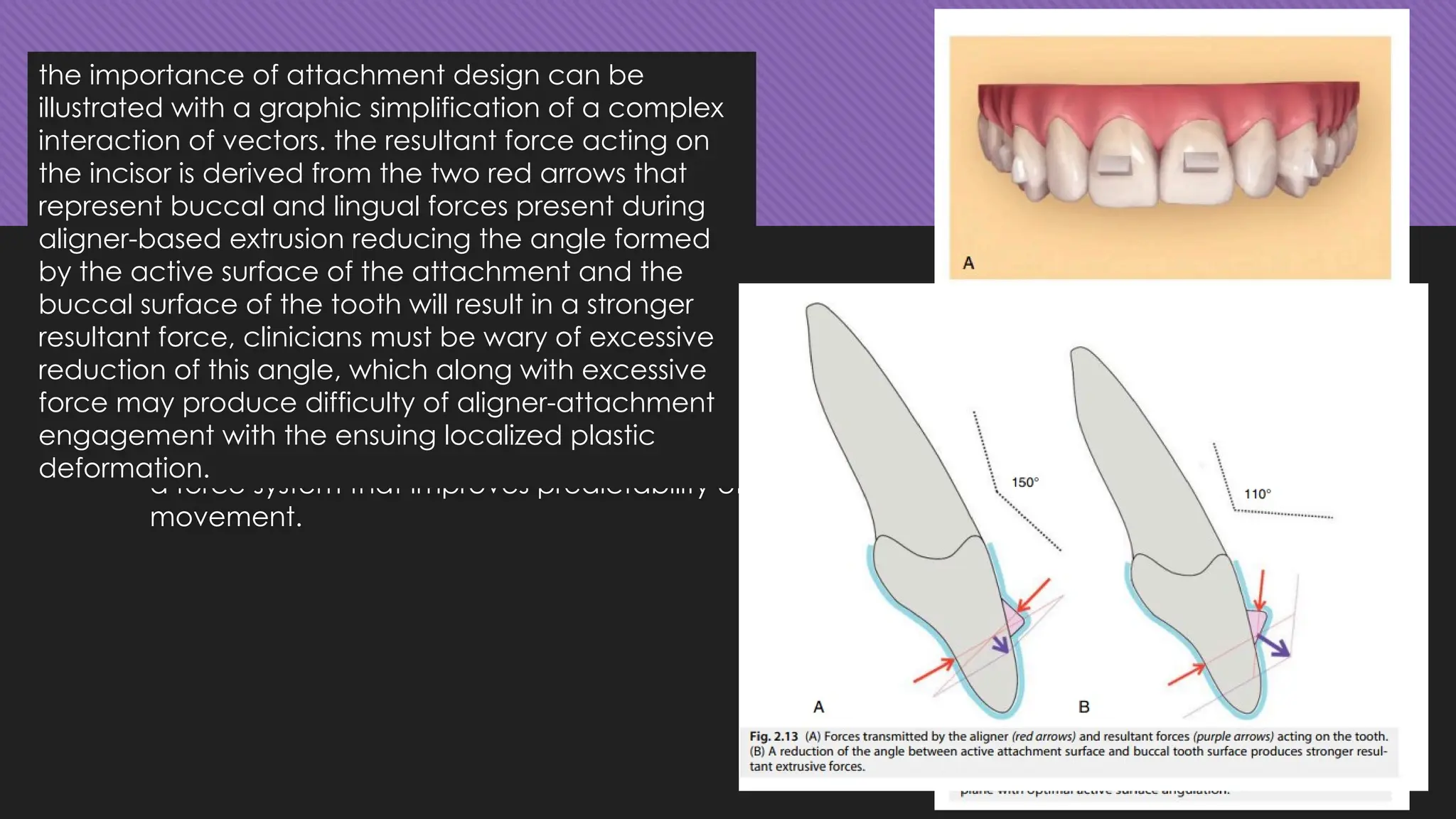 Aligner biomech-1.pptx biomechanics, orthodontics | PPTX