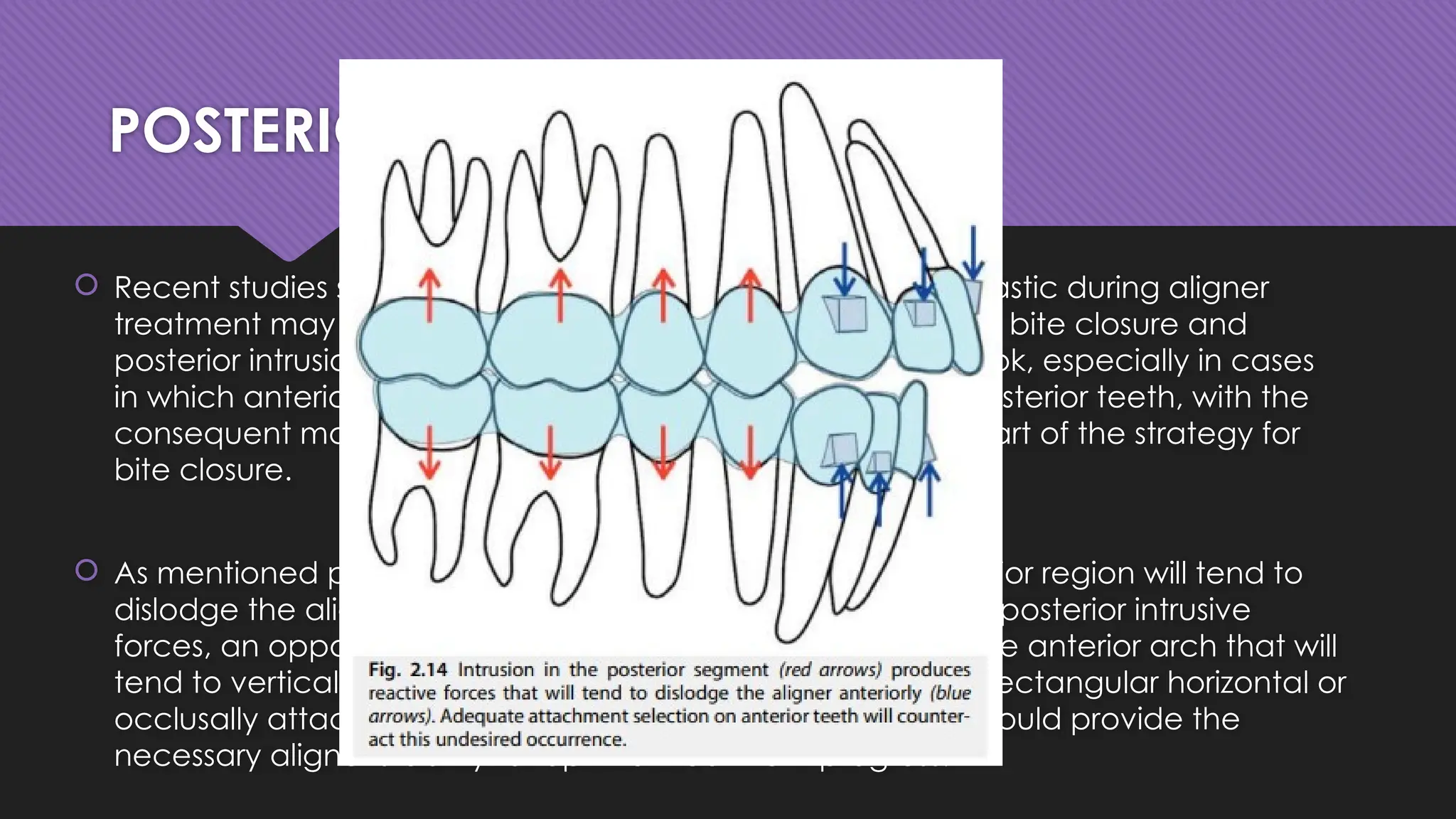 Aligner biomech-1.pptx biomechanics, orthodontics | PPTX