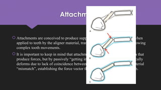 Aligner biomech-1.pptx biomechanics, orthodontics | PPTX | Dental ...