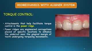 ALIGNER BIOMECHANICS JOURNAL CLUB P.pptx | Oral care | Personal Care
