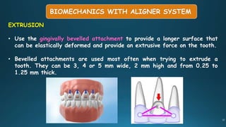 ALIGNER BIOMECHANICS JOURNAL CLUB P.pptx | Oral care | Personal Care