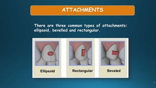 ALIGNER BIOMECHANICS JOURNAL CLUB P.pptx | Oral care | Personal Care