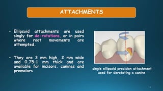 ALIGNER BIOMECHANICS JOURNAL CLUB P.pptx | Oral care | Personal Care