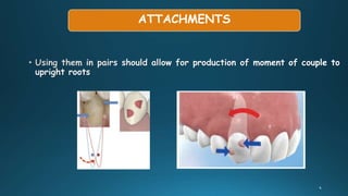 ALIGNER BIOMECHANICS JOURNAL CLUB P.pptx | Oral care | Personal Care