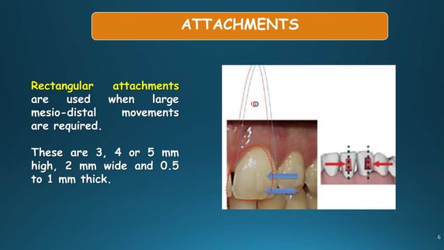 ALIGNER BIOMECHANICS JOURNAL CLUB P.pptx | Oral care | Personal Care