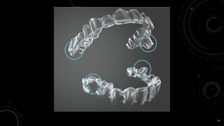 ALIGNER BIOMECHANICS in orthodontics.pptx