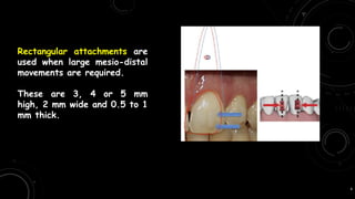 ALIGNER BIOMECHANICS in orthodontics.pptx