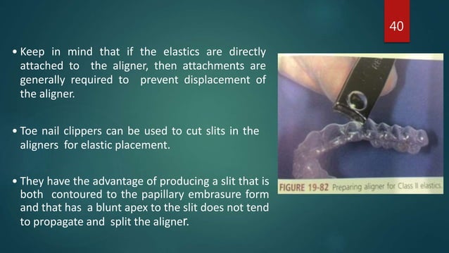 Aligners | PPTX