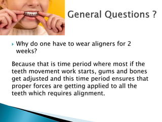 Aligner Theraphy - Demystified.pdf