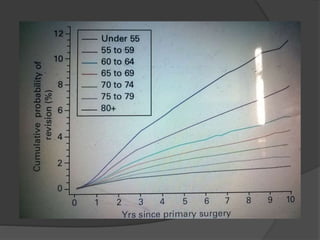 Alignment and fixation in total knee journal club.pptx